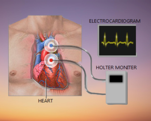 HOLTER TEST – Human Care Pathlabs
